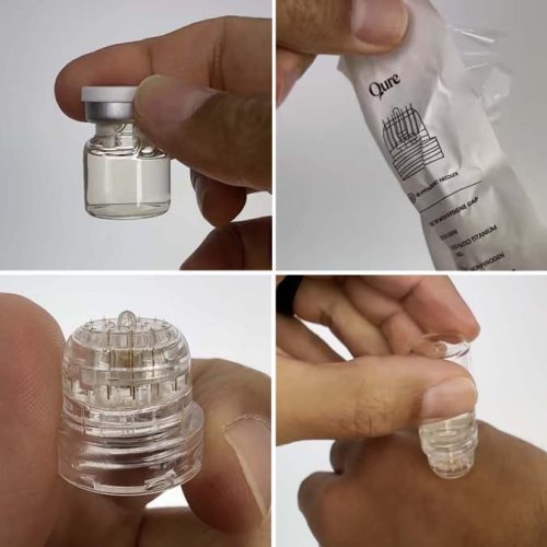 Qure Micro-Infusion Facial System Gives You Microneedling Results At ...